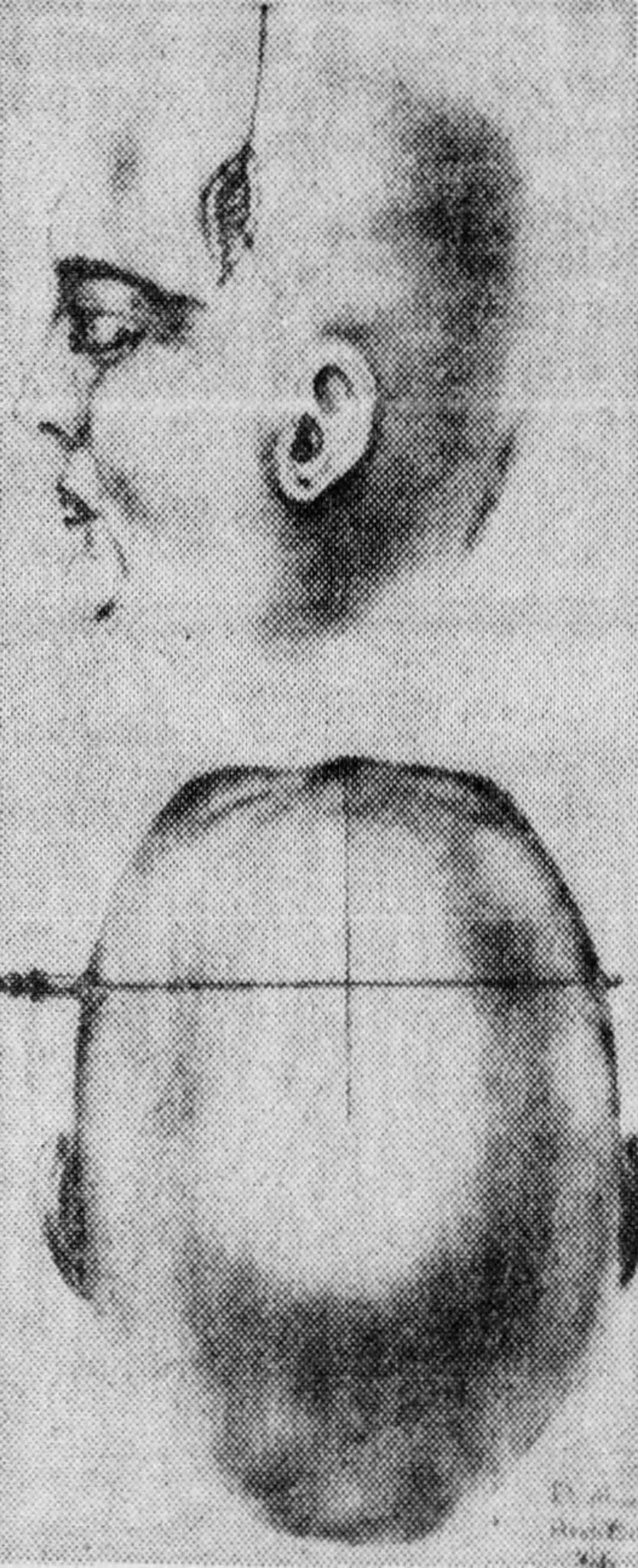 Home Care Following Leukotomy – Kentucky Historic Institutions