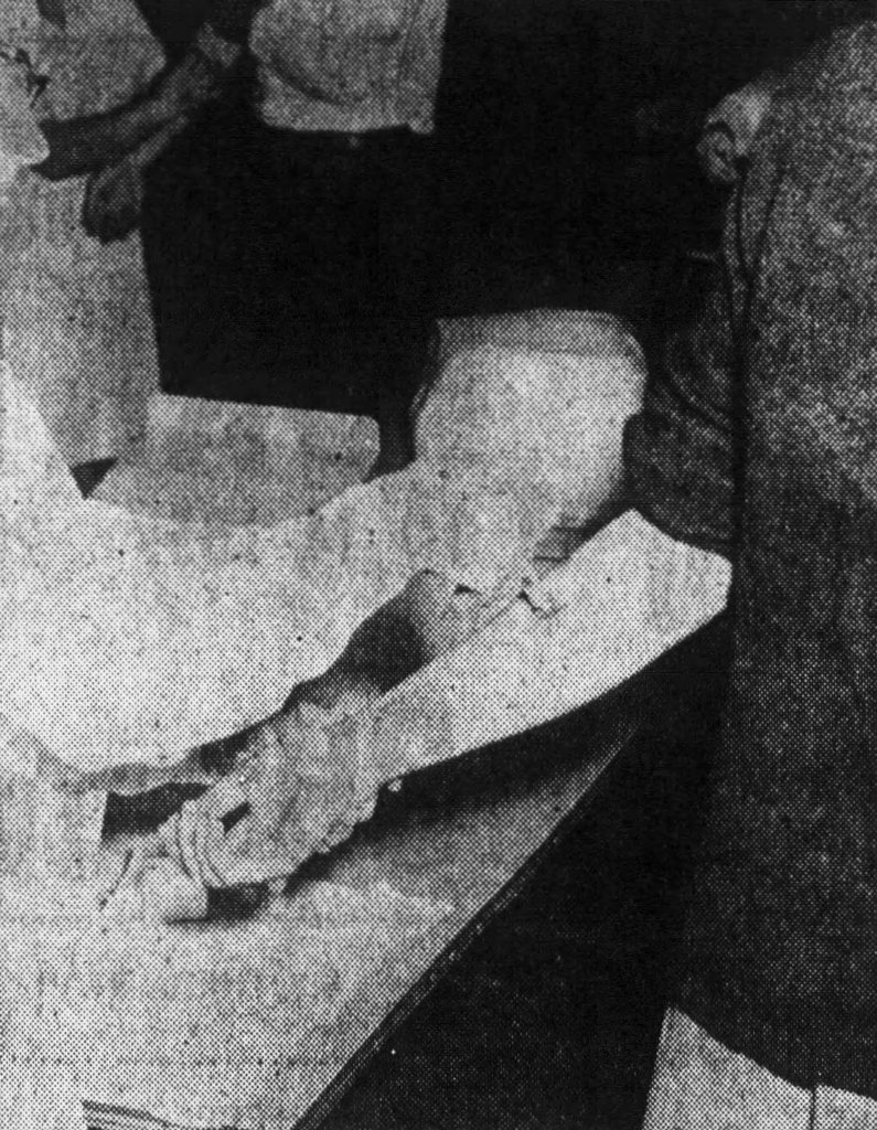 State Tuberculosis Sanatoria – Kentucky Historic Institutions