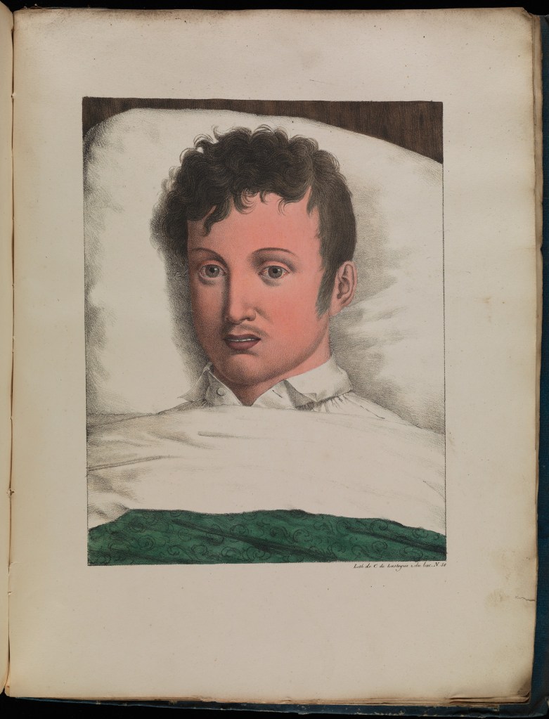 The 1878 Yellow Fever Epidemic at Hickman, Kentucky – Kentucky Historic ...